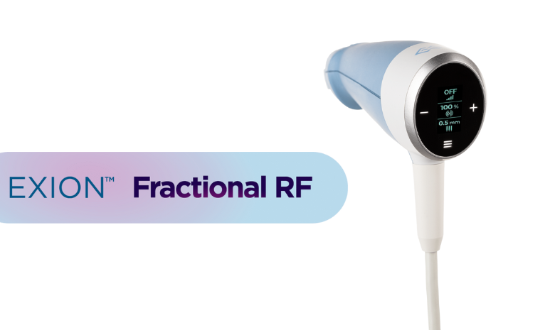 EXION™ Fractional RF Microneedling ⋆ Science Of Beauty